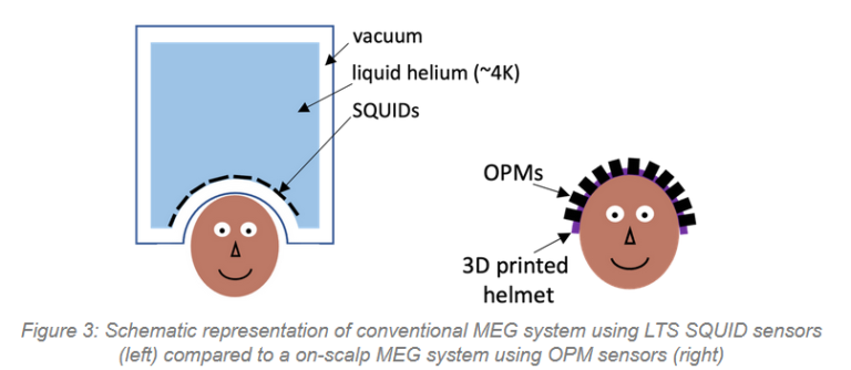MAG4Health | High-End Brain Imaging with 4He OPM-MEG